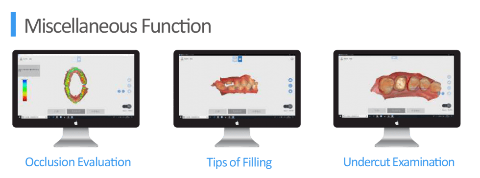 Runyes 3DS Digital Impression Scanner - Cardiodental